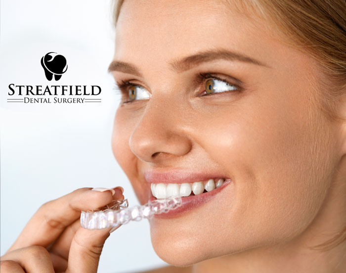 Straight Teeth: How to Get Straighter Teeth? | Streatfield Dental, Harrow